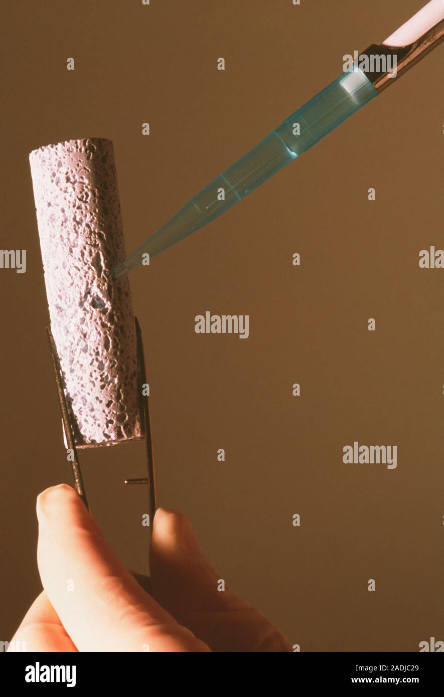 Bioceramic used in bone reconstruction. Technician pipetting a solution ...