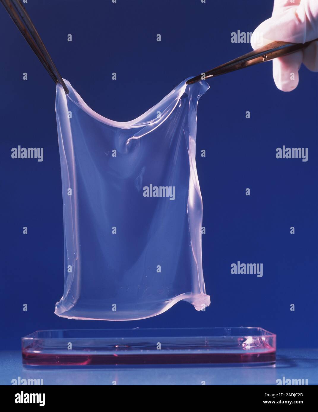 Skin strip. Technician holding an epidermal strip grown in the ...