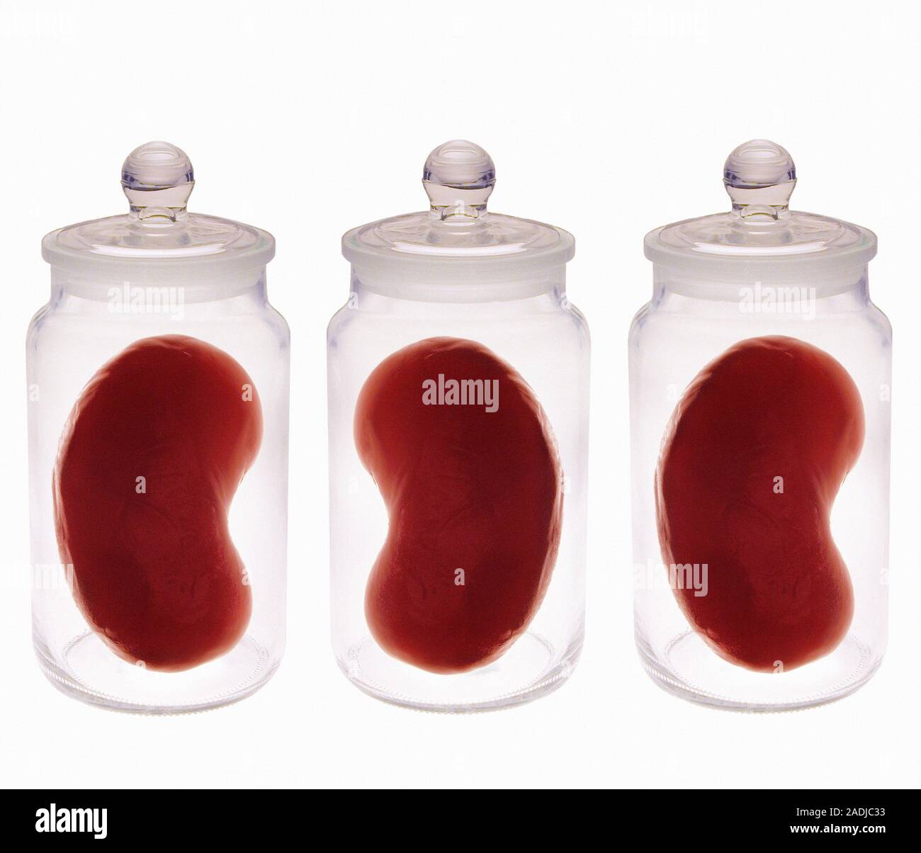 Spare kidneys. Conceptual computer artwork of spare kidneys stored in ...