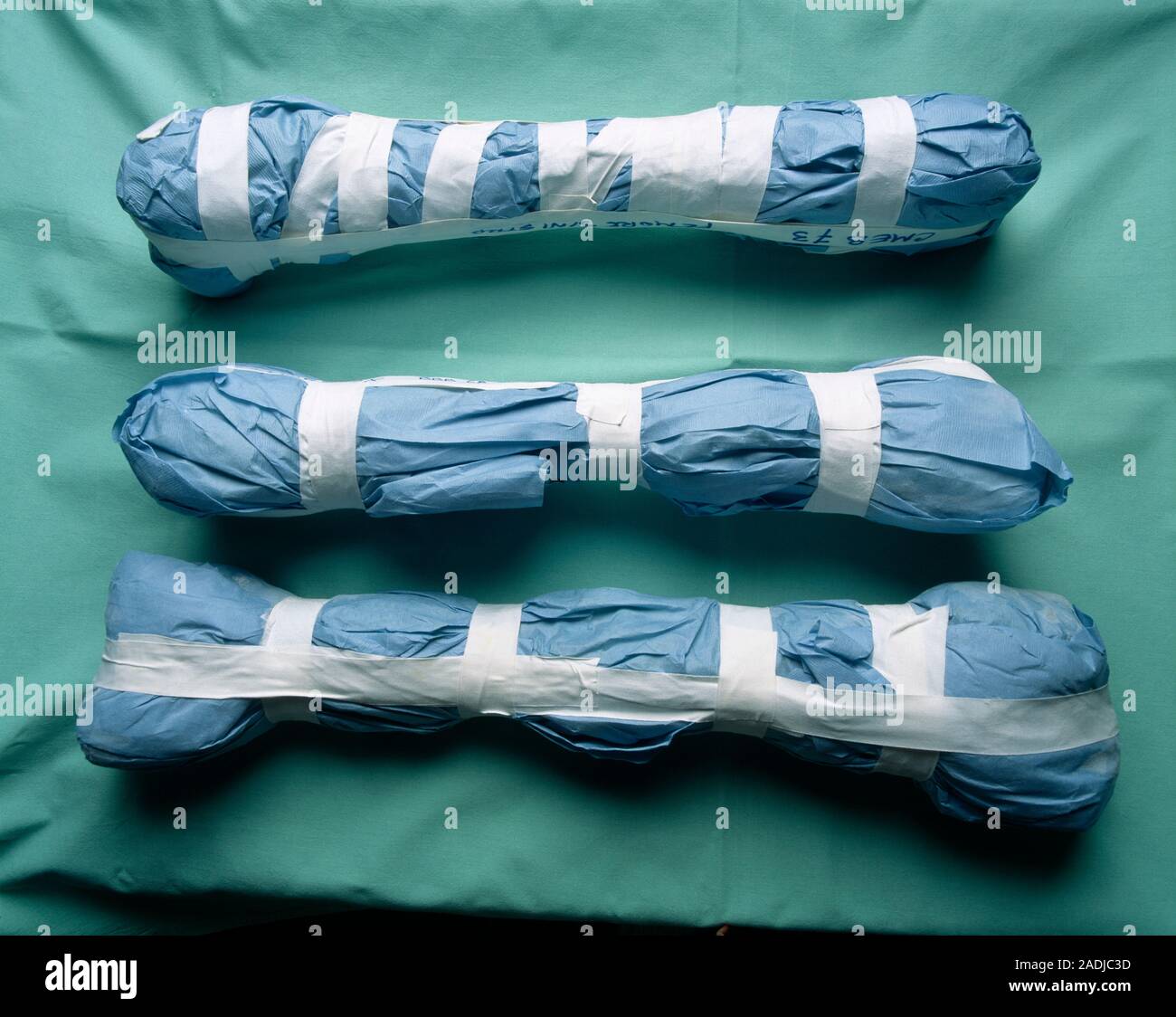 Frozen bones. Frozen femur (thigh) bones taken out of storage at a bone ...