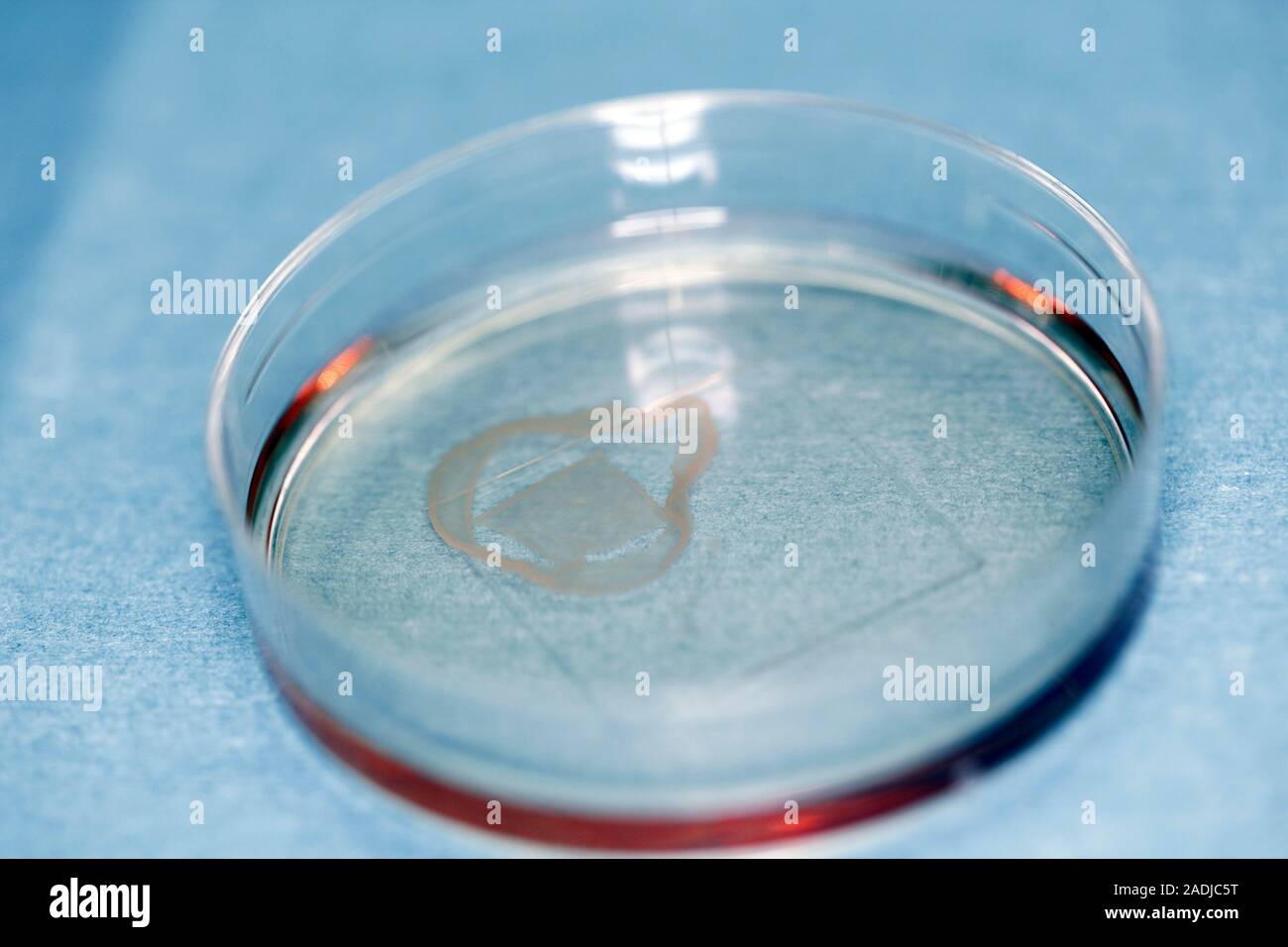 Skin sheet culture being grown in a petri dish in a laboratory. The ...