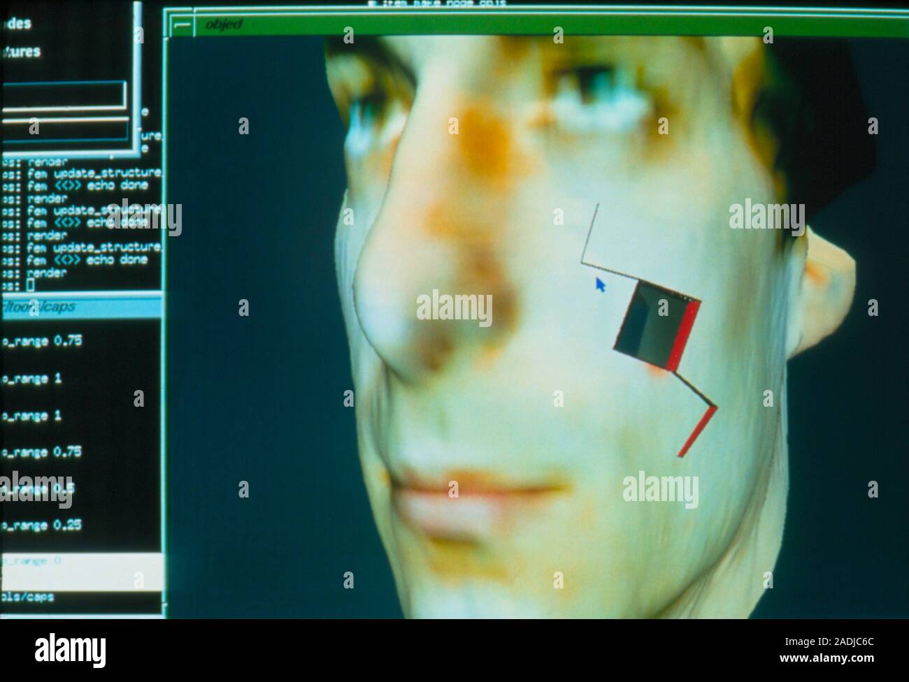 Plastic surgery simulator. First in a series of three screen displays ...