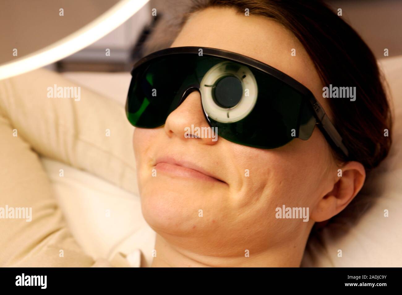 Cosmetic skin treatment. Woman wearing goggles to protect her eyes from ...