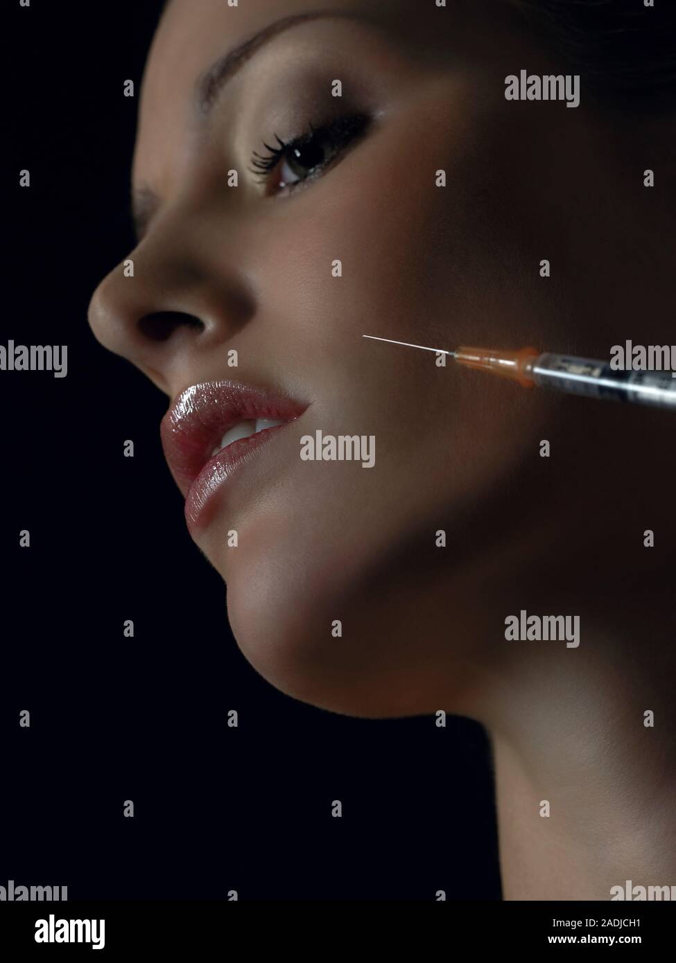 Botox treatment. Botox is a neurotoxin used for cosmetic purposes. The ...