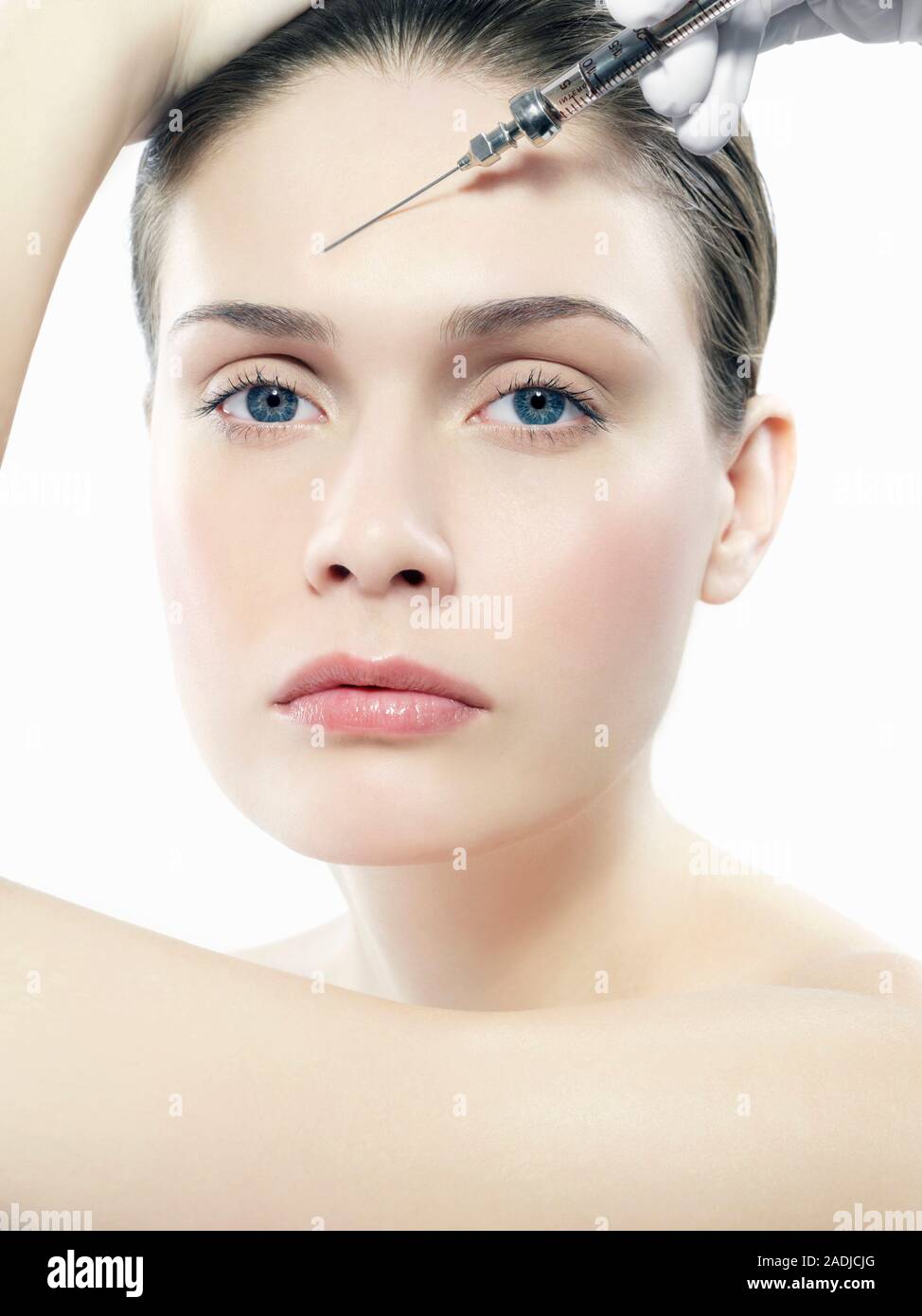 MODEL RELEASED. Botox treatment, conceptual image. Botox is a ...