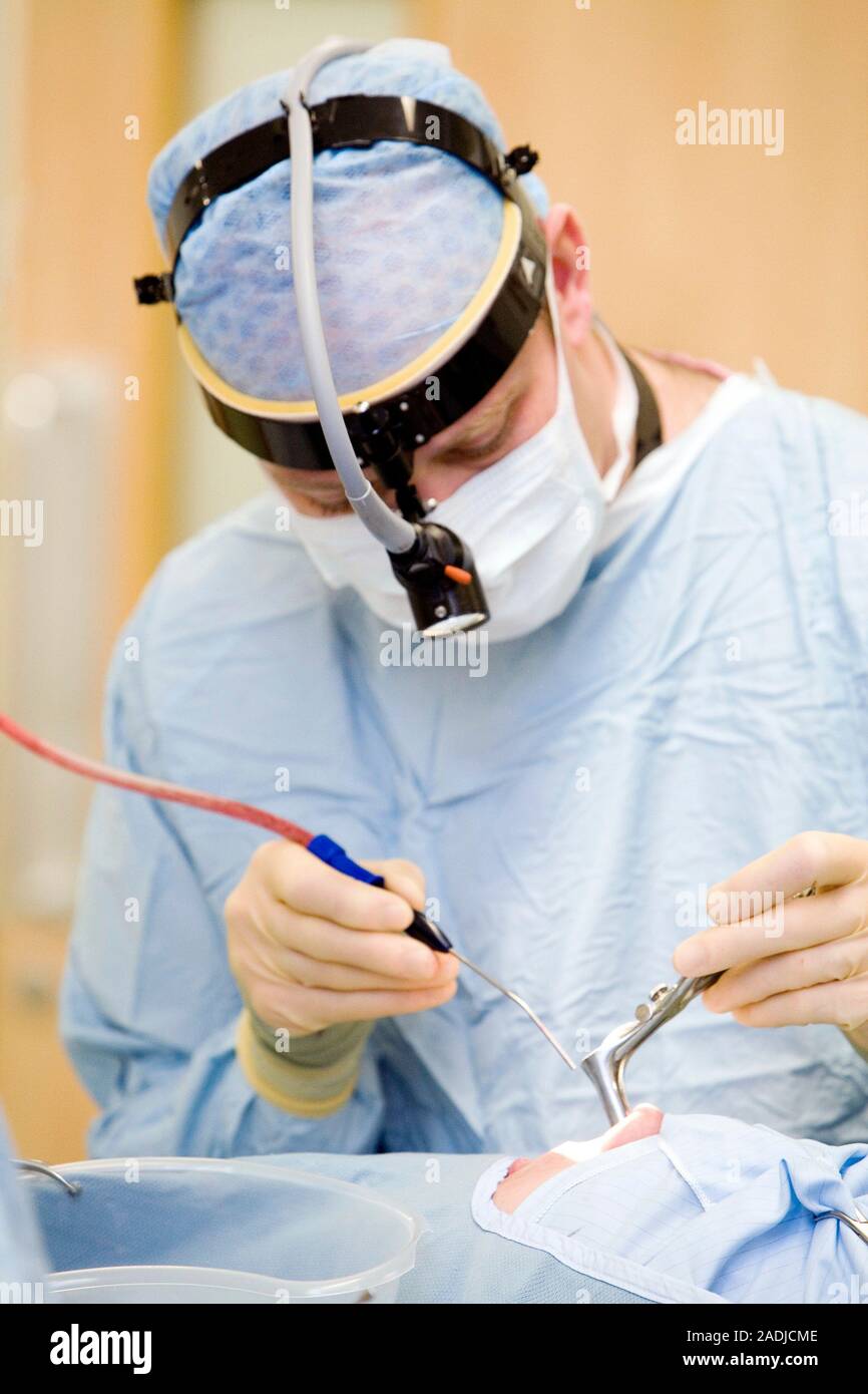 Septoplasty operation. Surgeon performing an operation to straighten ...