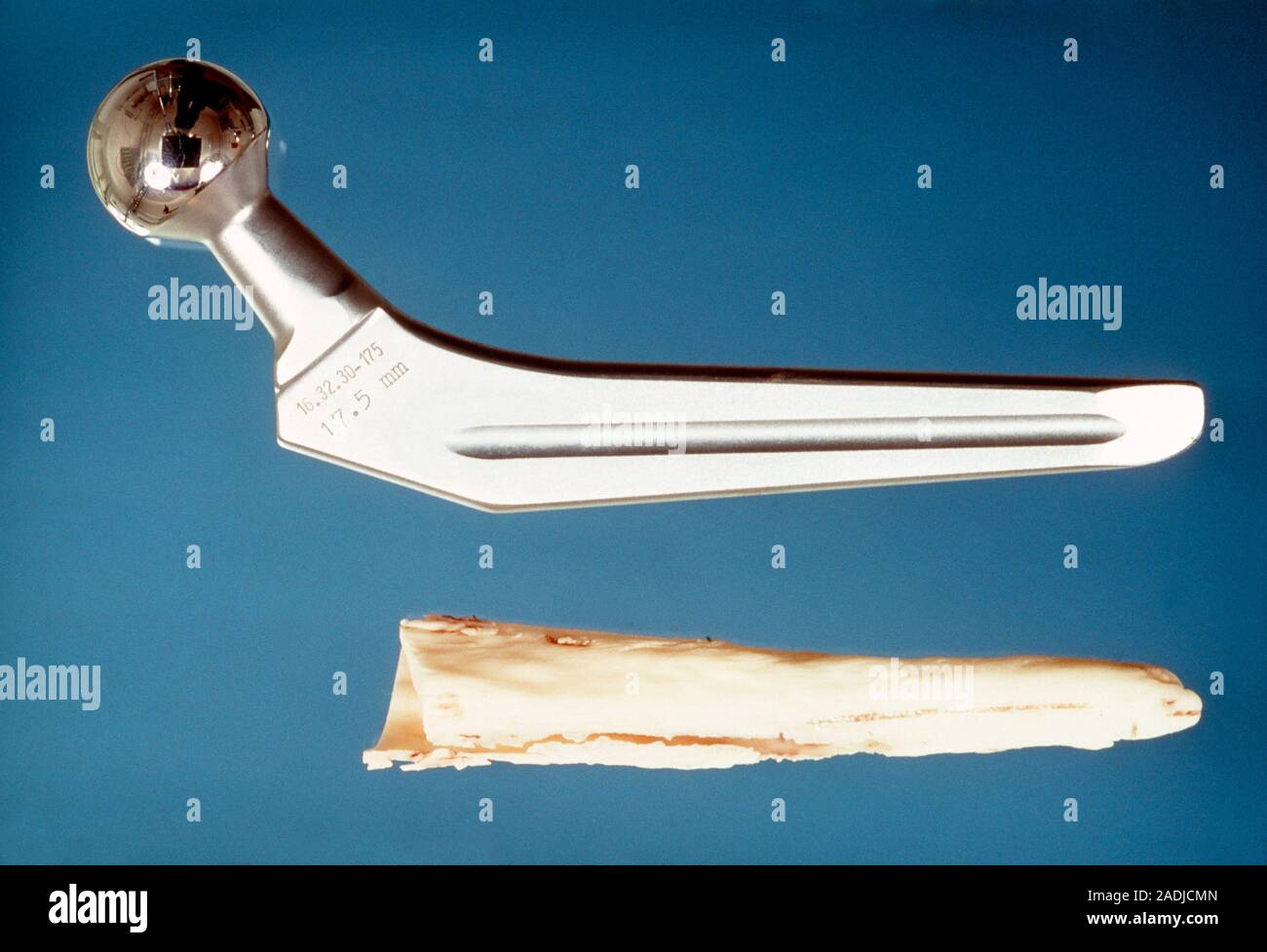 Artificail hip-joint with corresponding shaft of bone from femur Stock ...