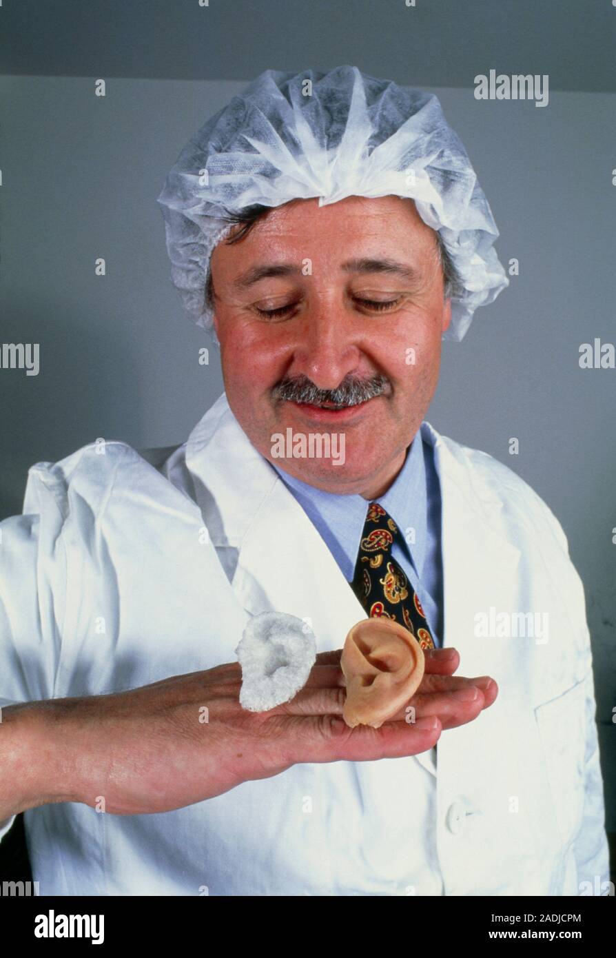 Artificial ears. Researcher compares a conventional prosthetic ear with ...