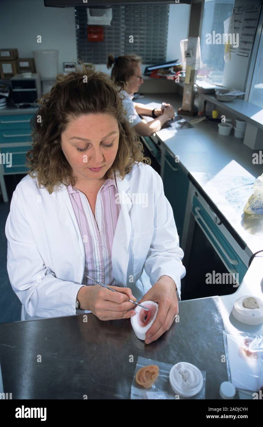MODEL RELEASED. Prosthetic eye. A maxillofacial prosthetist making a ...