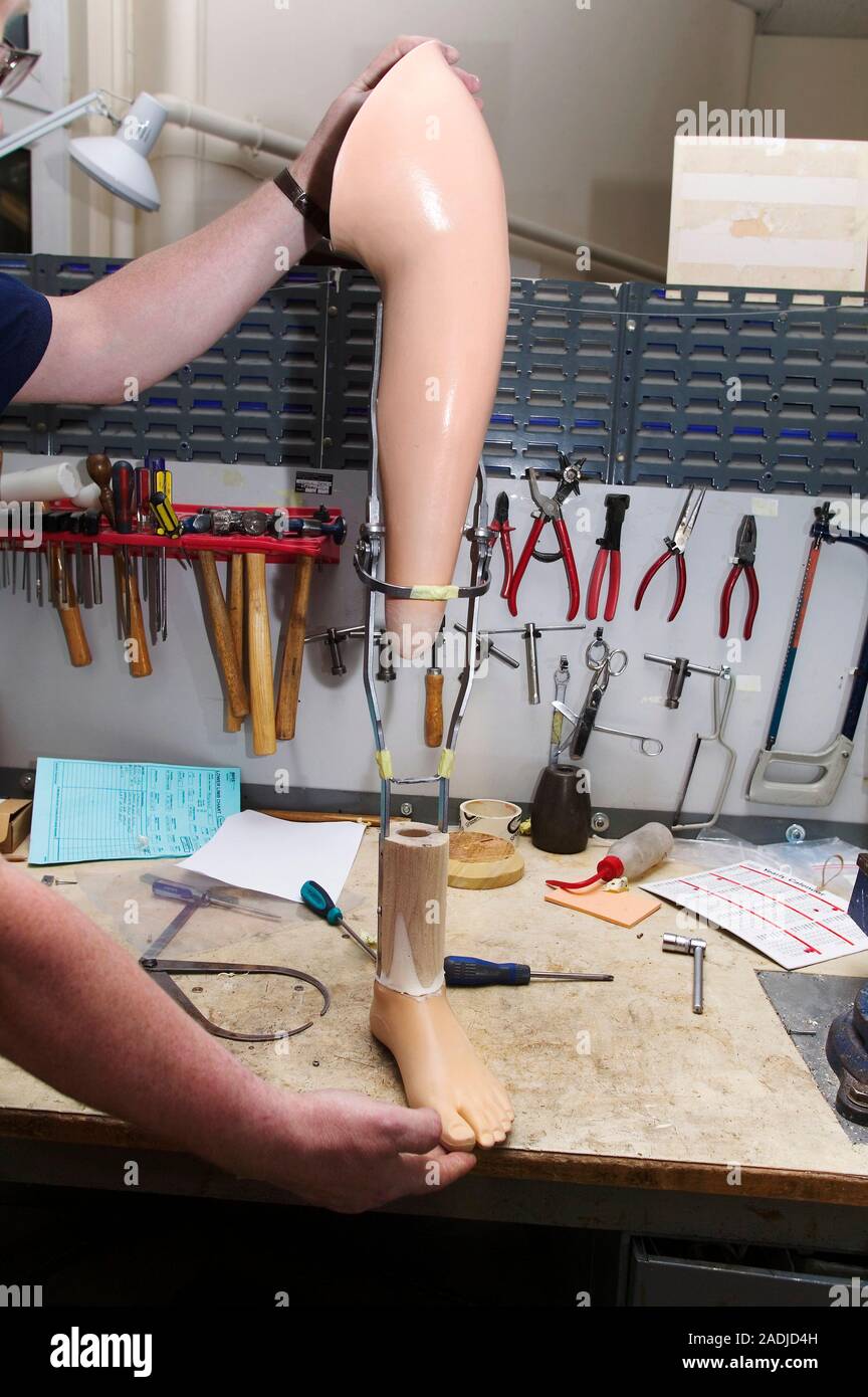 MODEL RELEASED. Prosthetic limb manufacture. Technician holding a ...