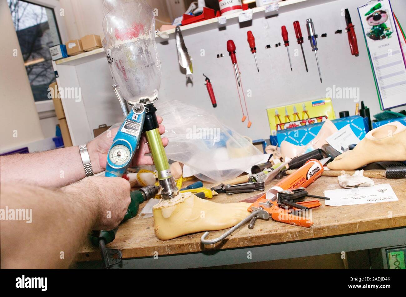 MODEL RELEASED. Prosthetic limb manufacture. Technician building a ...