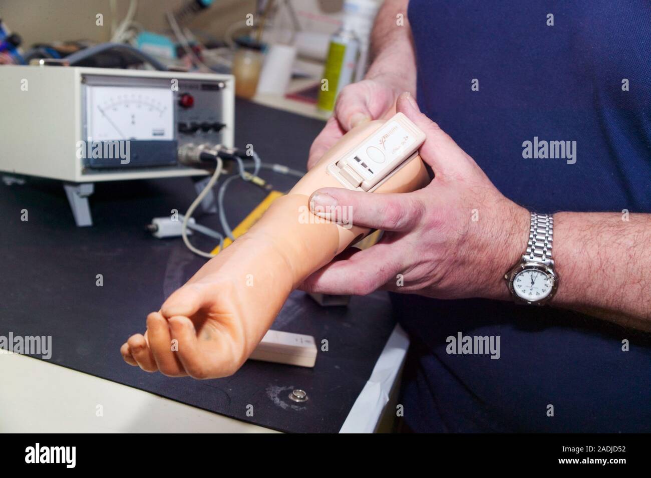 MODEL RELEASED. Prosthetic limb manufacture. Technician inserting a ...