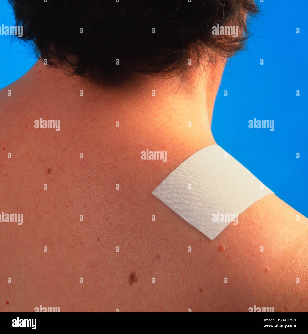 Pain-relief patch. Woman wearing a pain-relief patch on her shoulder ...