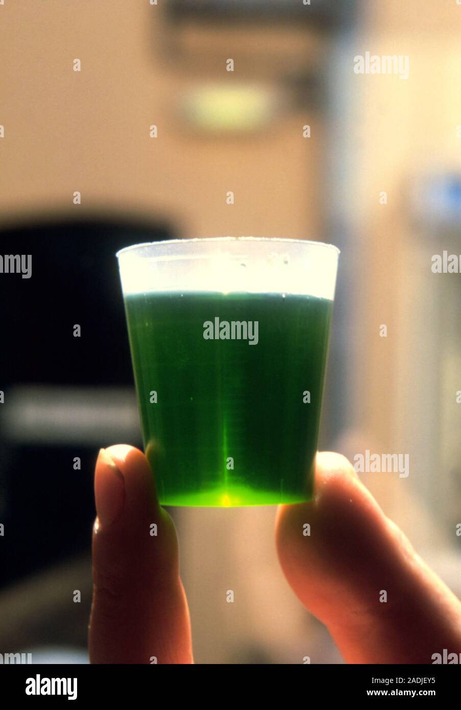 Methadone. Hand holding a beaker containing a solution of the drug ...