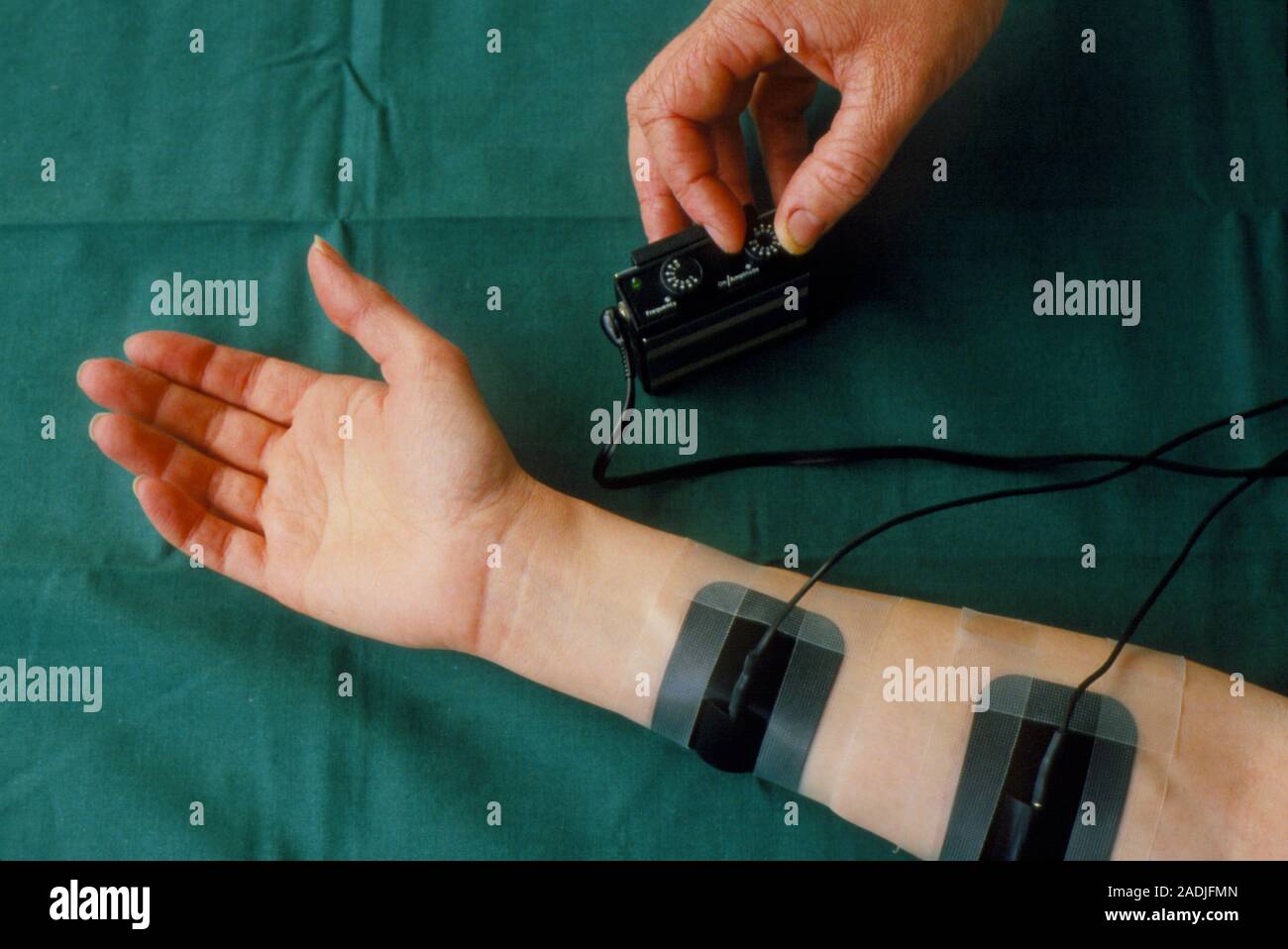 Person undergoing Transcutaneous Electrical Nerve Stimulation (TENS) in ...
