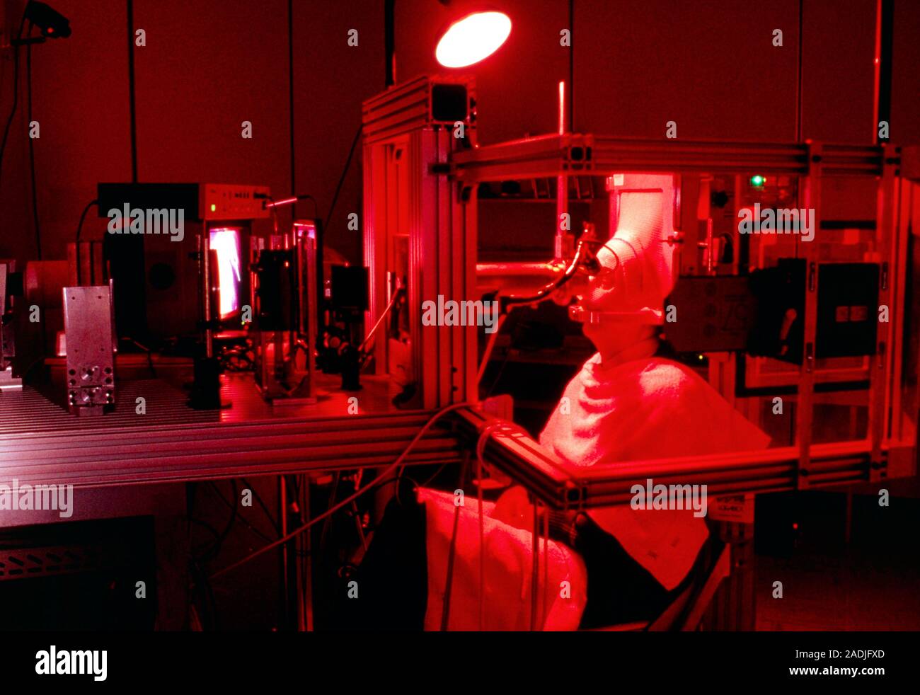 Proton radiotherapy to treat a cancer of the eye. Seated & isolated in ...