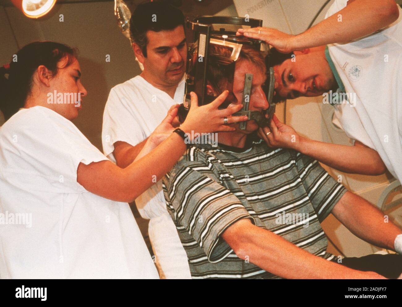 Gamma knife radiotherapy. Patient having a head frame fitted in ...
