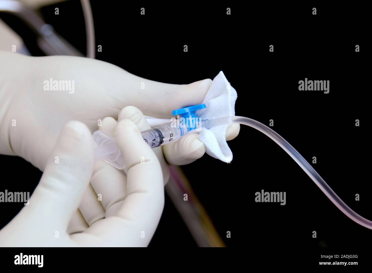 MODEL RELEASED. Chemotherapy session. Syringe of cancer drugs being ...