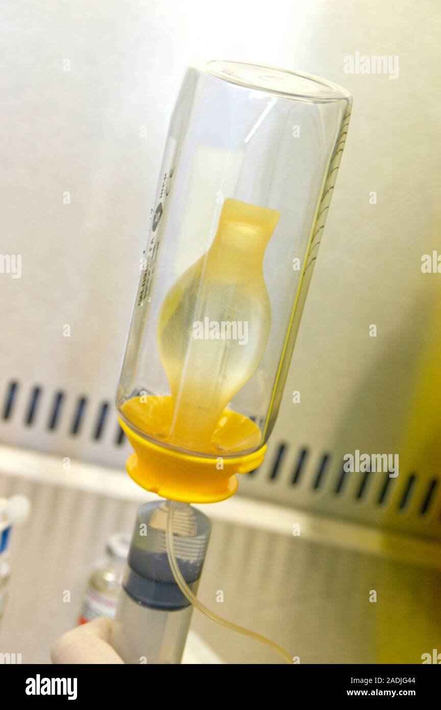 Cancer drug pump. This device is designed to deliver measured doses of ...