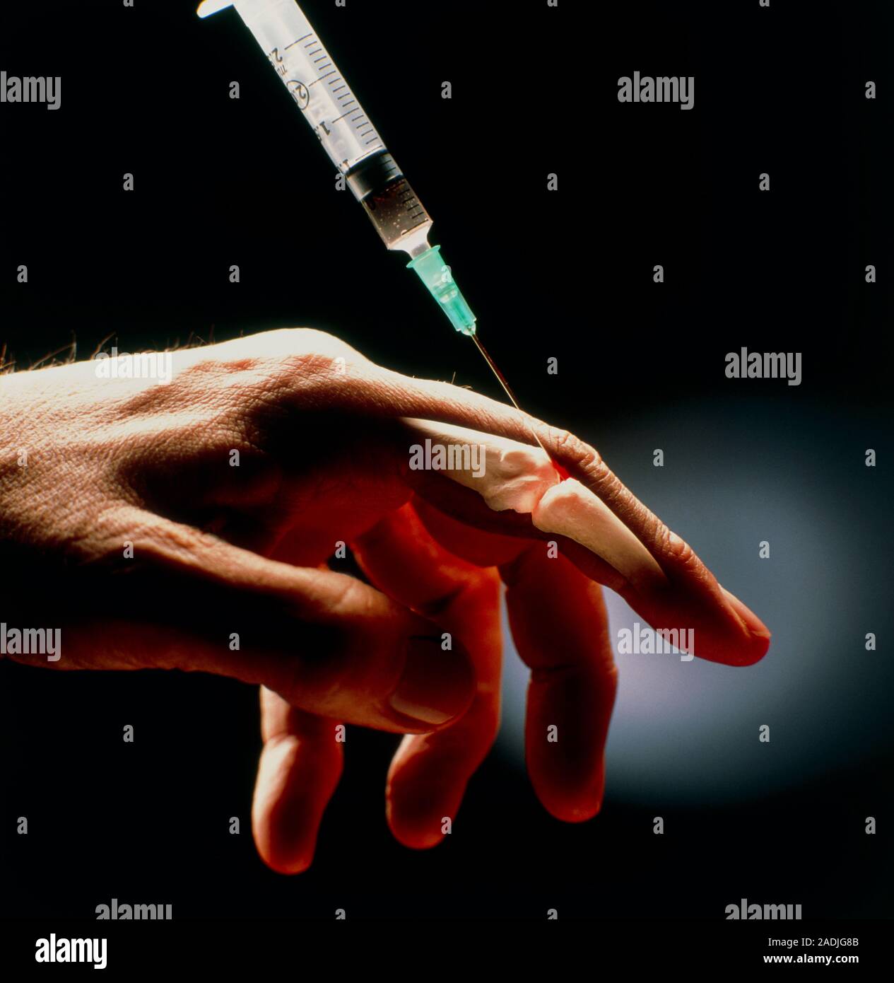 Finger injection. Conceptual image of an injection into a finger joint ...