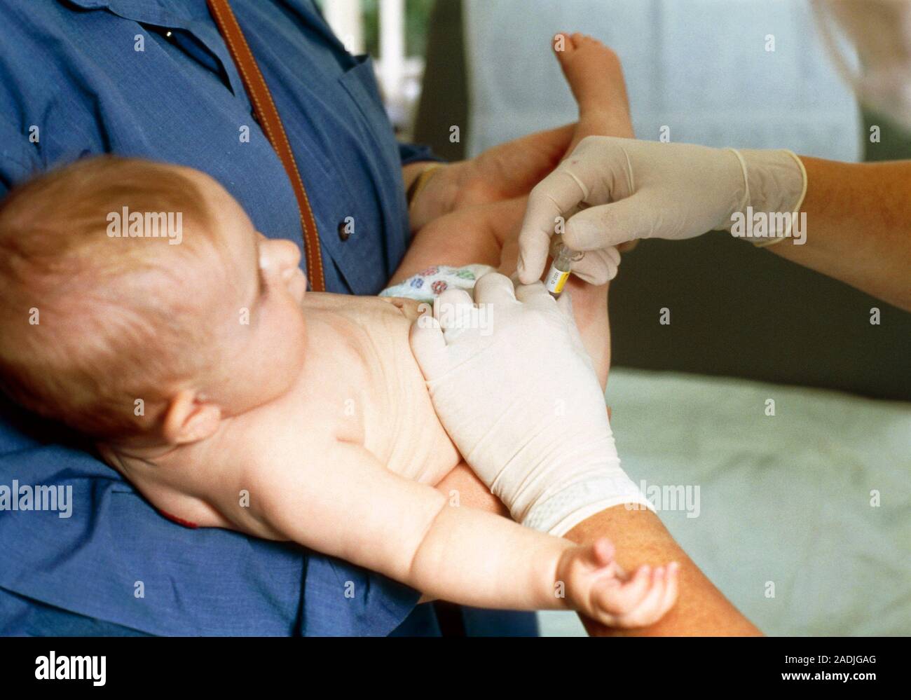 MMR vaccination. Baby receiving the MMR triple vaccination. This ...