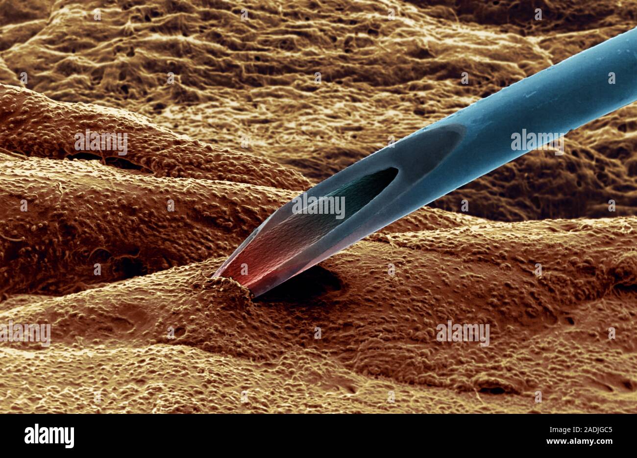 Injection. Coloured scanning electron micrograph (SEM) of a needle ... Injection. Coloured scanning electron micrograph (SEM) of a needle ...