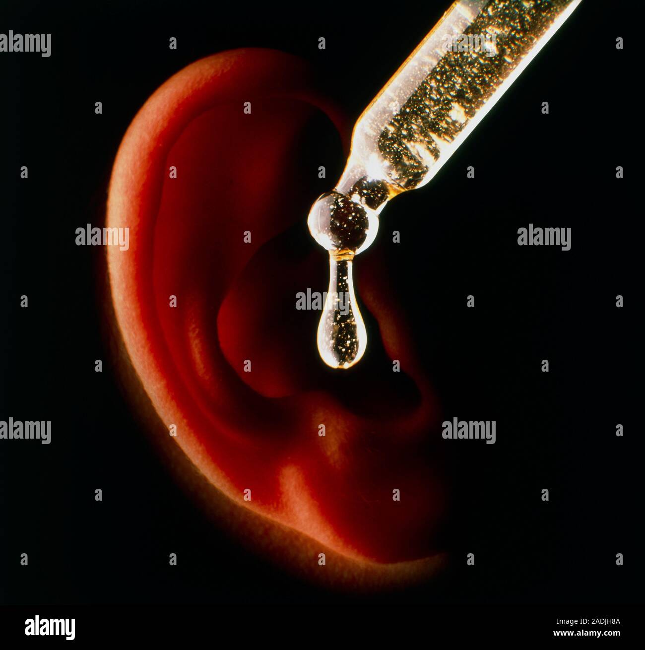 Ear-drop treatment. Patient's ear near an ear dropper dispensing a ...