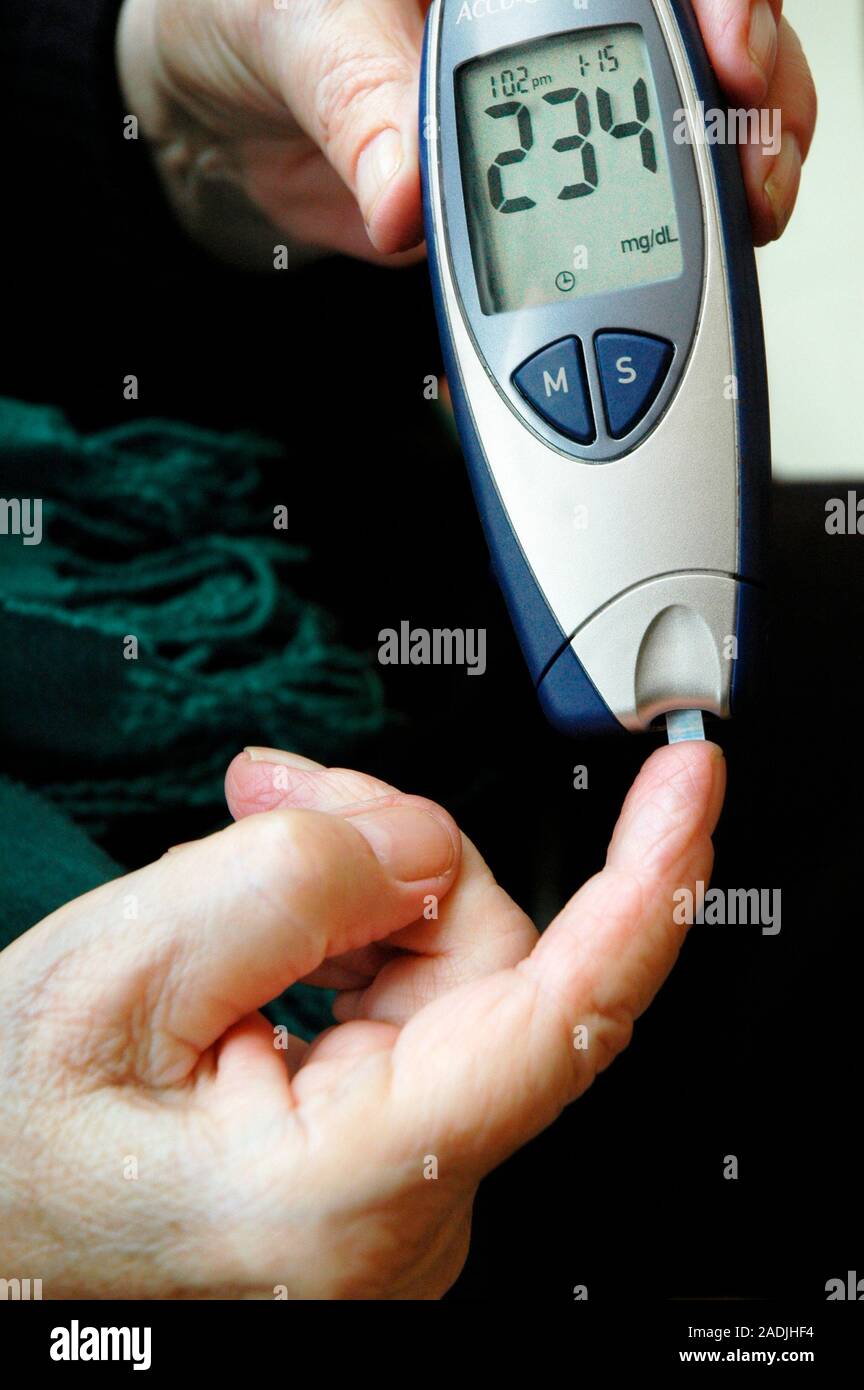 MODEL RELEASED. Blood glucose test. Close-up of a 78 year old woman ...