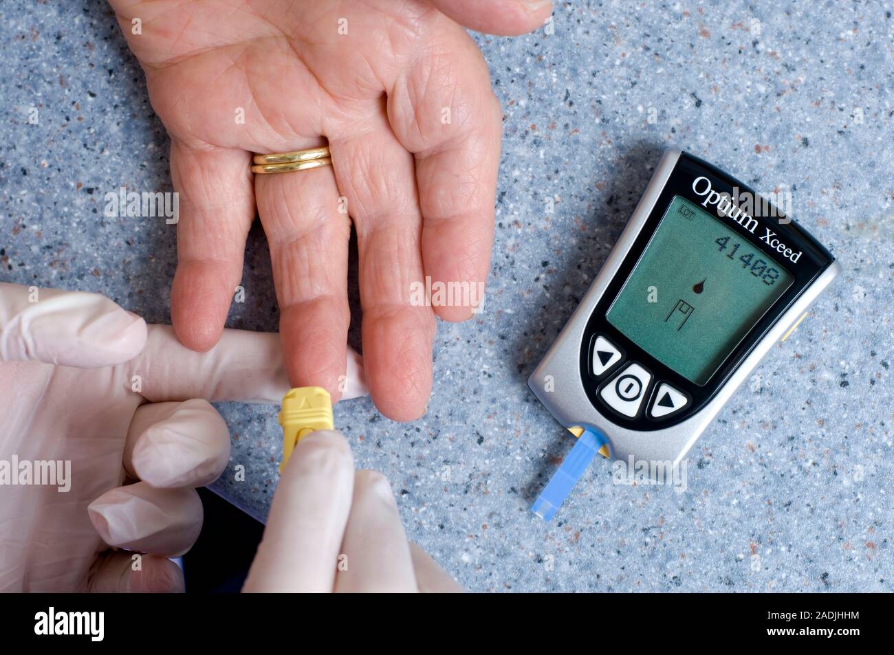 Blood sugar testing. Healthcare worker pricking an elderly woman's ...