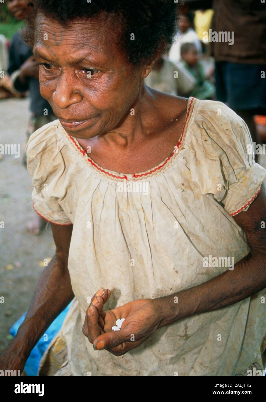 Elephantiasis drugs. Woman holding elephantiasis (lymphatic filariasis ...
