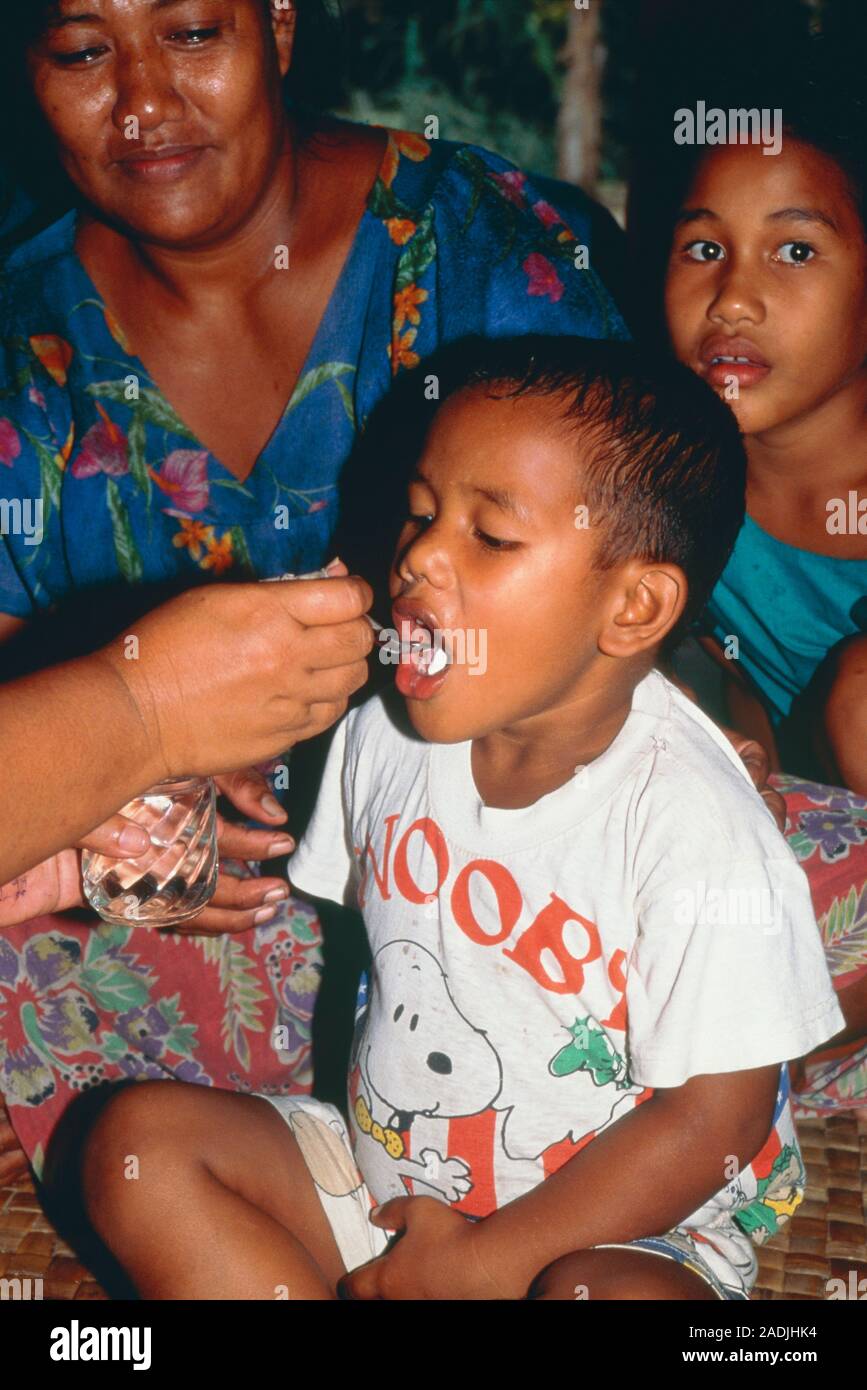 Filariasis treatment. Nurse placing a tablet of the drug albendazole ...