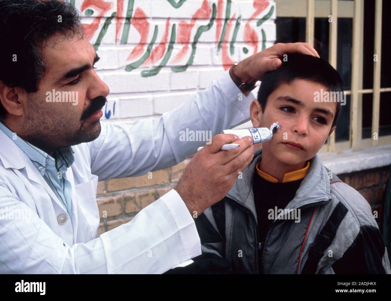 Cutaneous leishmaniasis. Third World doctor treating a cutaneous ...