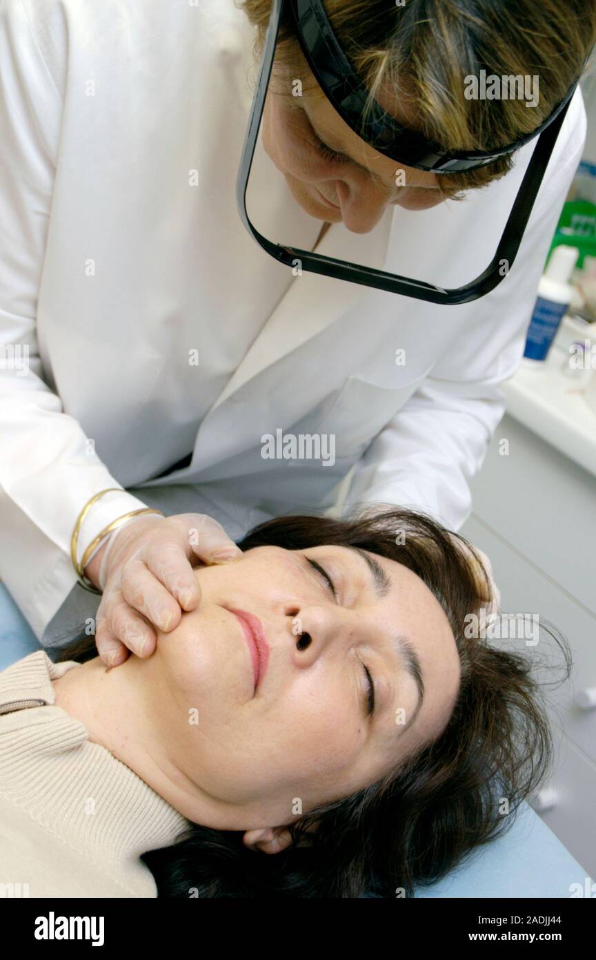MODEL RELEASED. Skin examination. Dermatologist examining a woman's ...