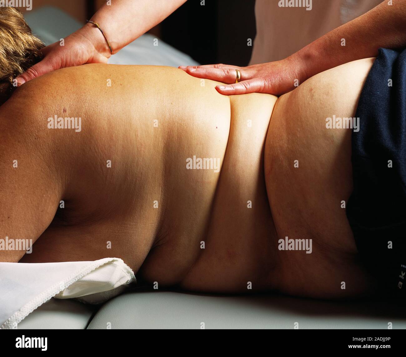 Massage Overweight Woman Recieving A Massage Massage Can Improve Skin And Muscle Tone And