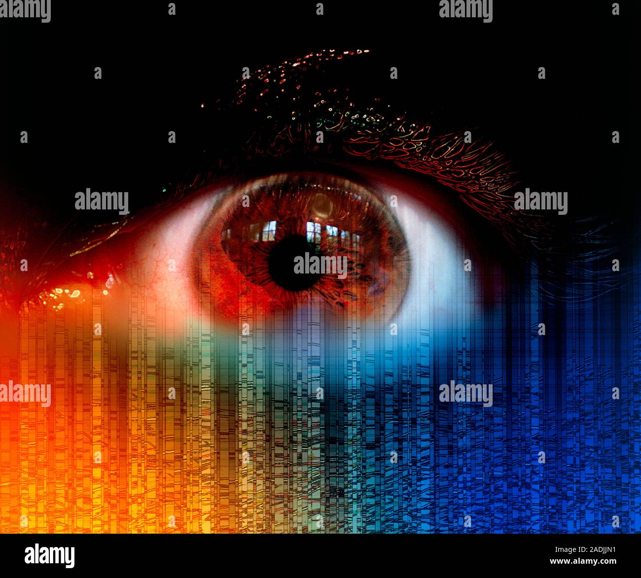 Iridology cholesterol ring. Conceptual computer- enhanced image of a ...