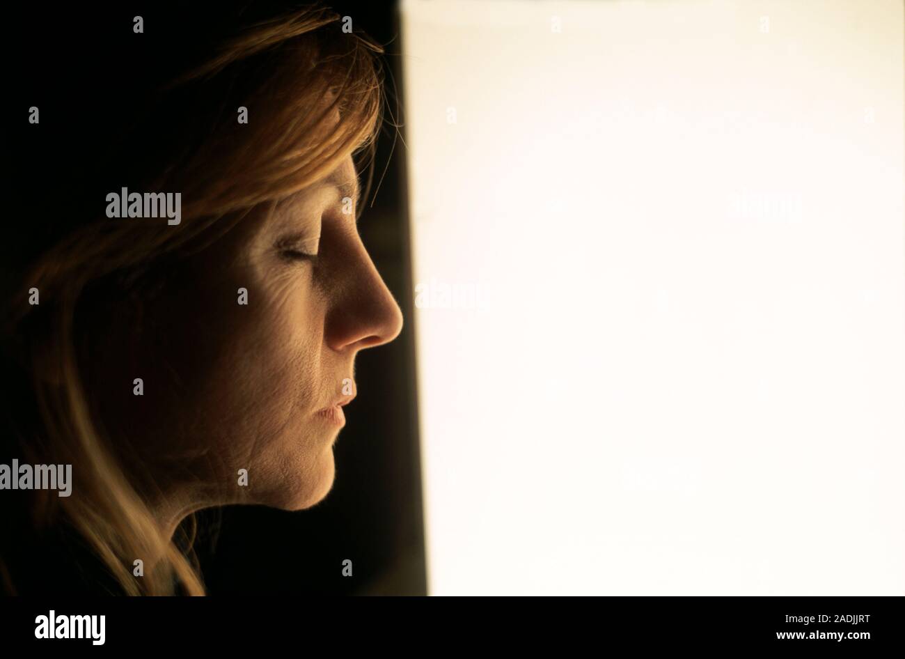 Phototherapy. Forty year old woman facing a light box during a ...
