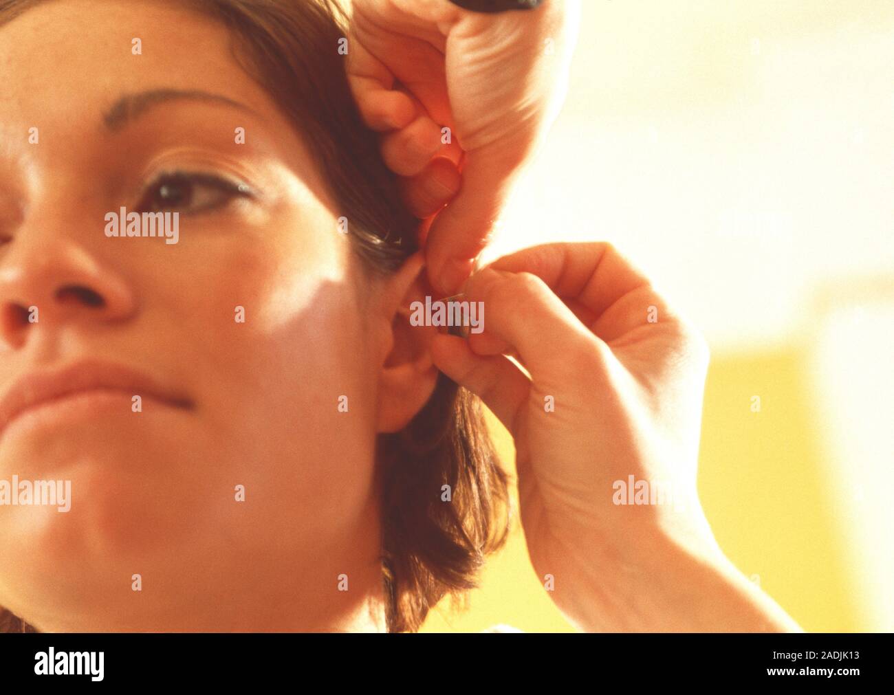 Acupuncture needle being placed in a woman's ear. This traditional ...