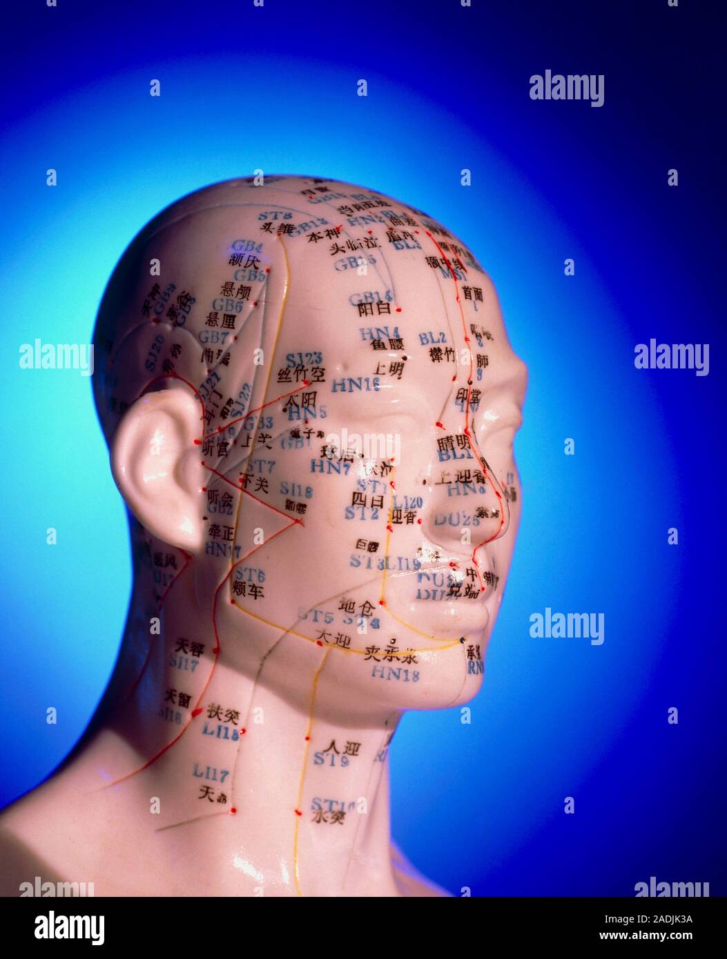 Acupuncture head. Cast of the head of a Chinese man showing a ...