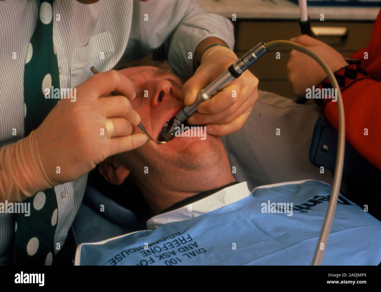 Dental examination. Dentist drills the tooth of a male patient. Tooth ...