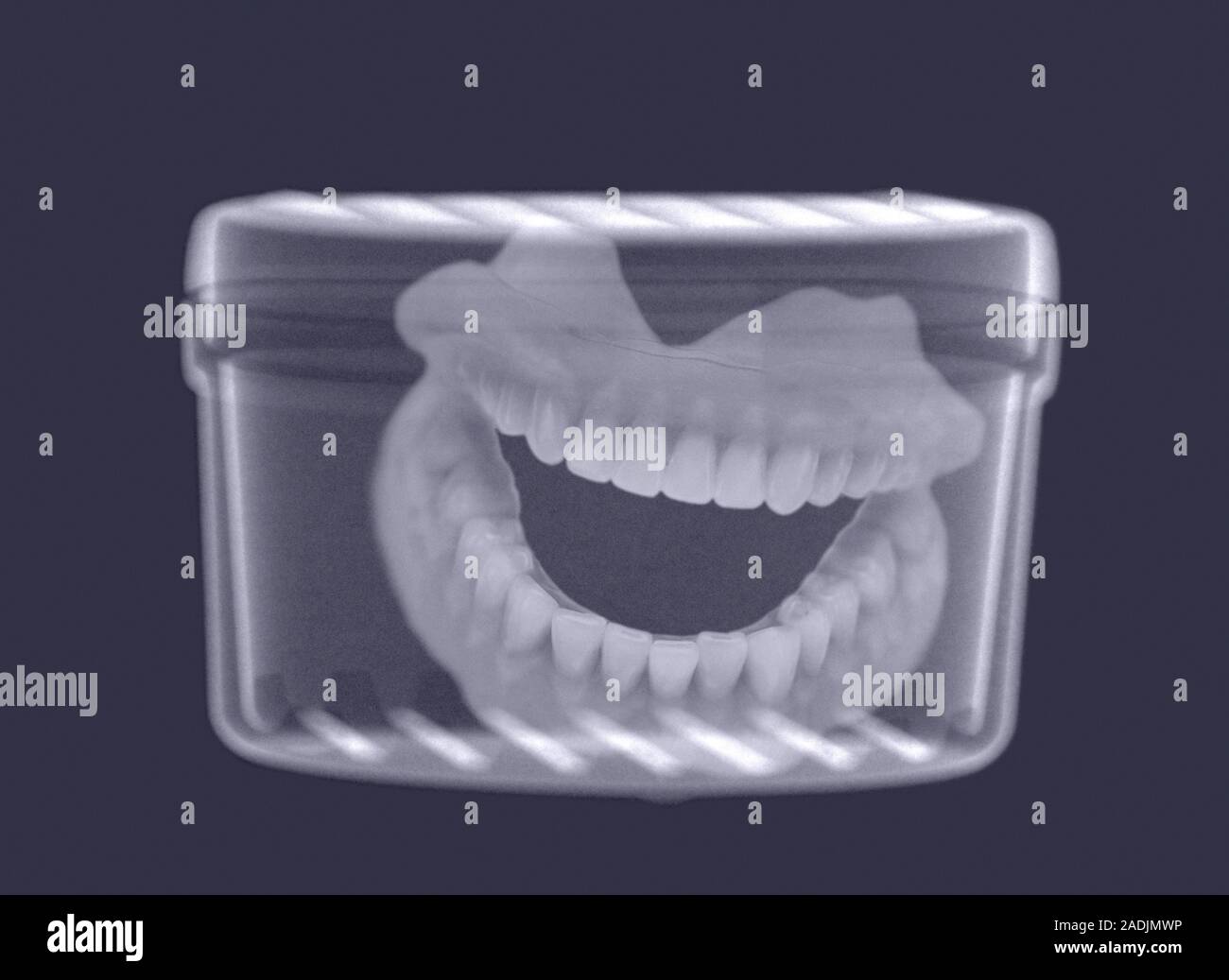 False teeth. X-ray of a container holding two sets of lower false teeth ...