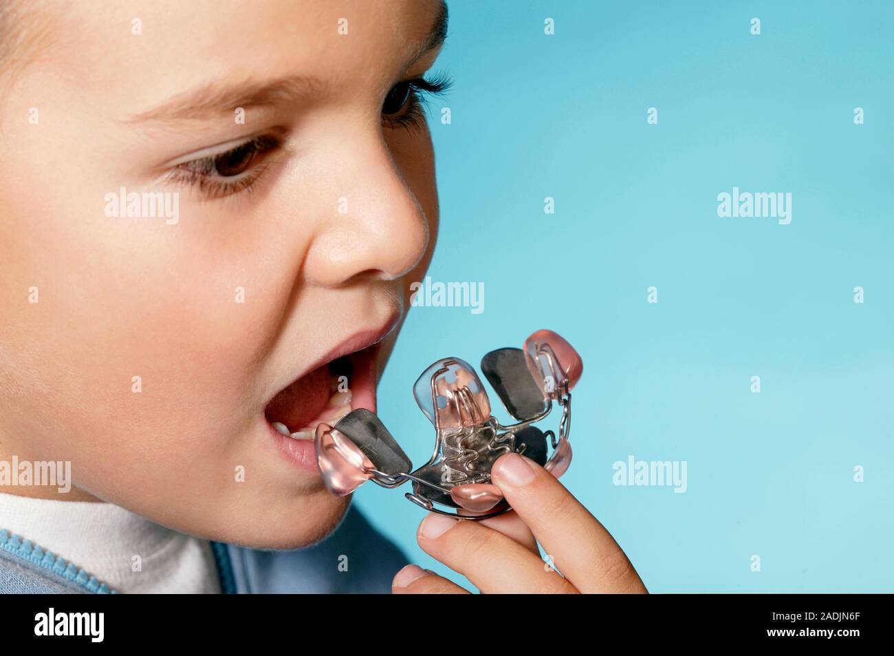 MODEL RELEASED. Young boy with a dental retainer. A dental retainer is ...