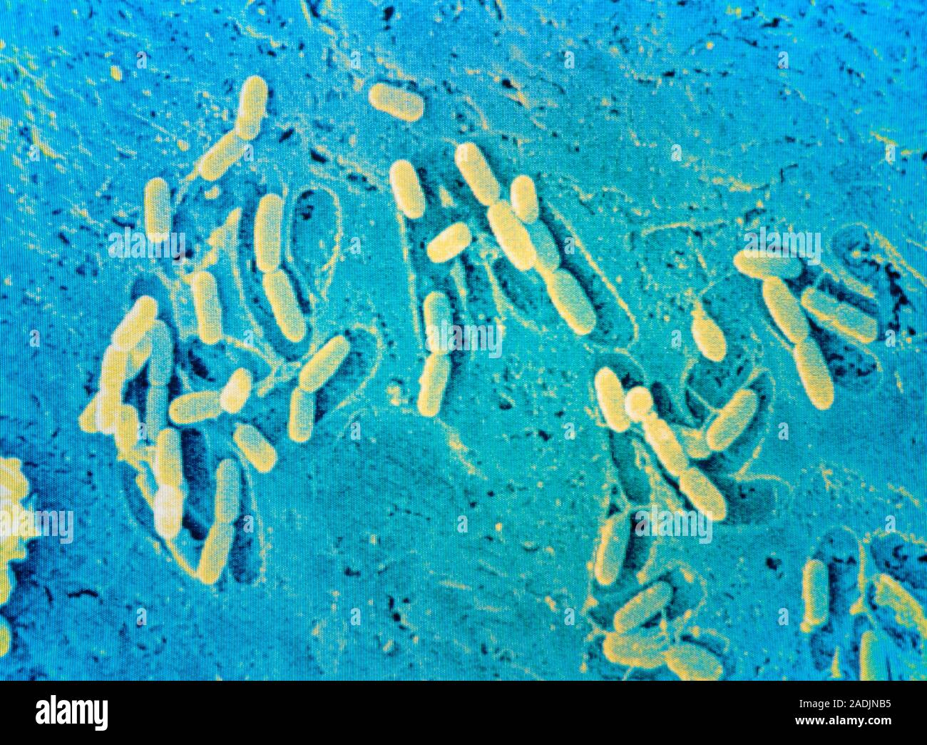 Oral hygiene. Coloured scanning electron micrograph of bacteria ...