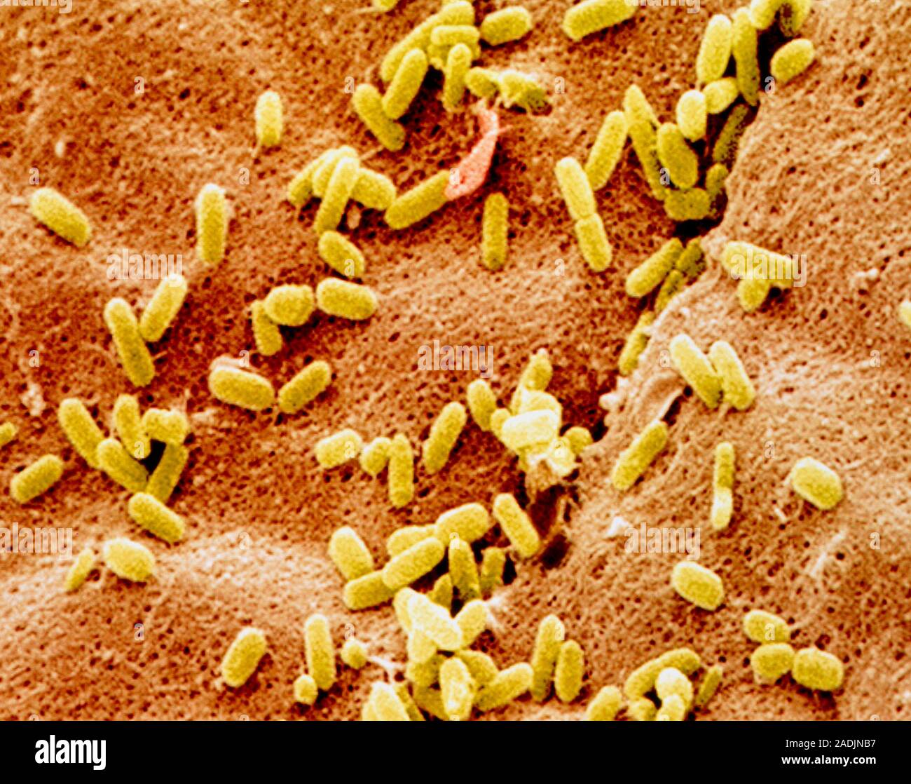 Oral hygiene. Coloured scanning electron micrograph of bacteria ...