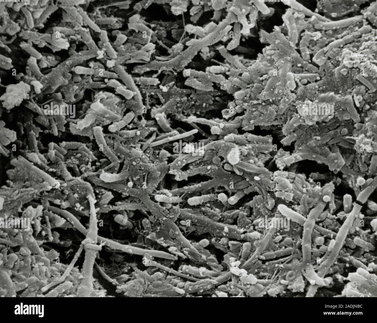 Dental plaque. Scanning electron micrograph (SEM) of an unidentified ...