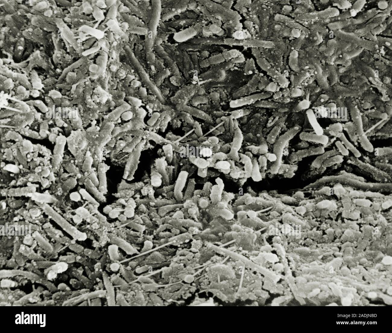 Dental plaque. Scanning electron micrograph (SEM) of an unidentified ...