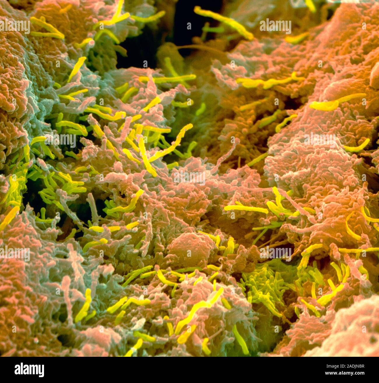 Tooth decay bacteria. Coloured Scanning Electron Micrograph (SEM) of ...