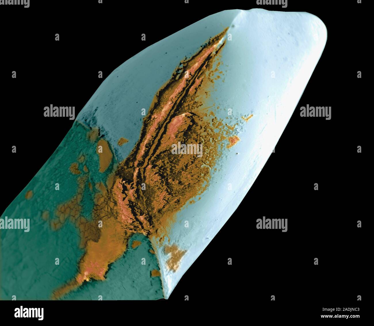Dental crown. Coloured scanning electron micrograph (SEM) of a tooth ...