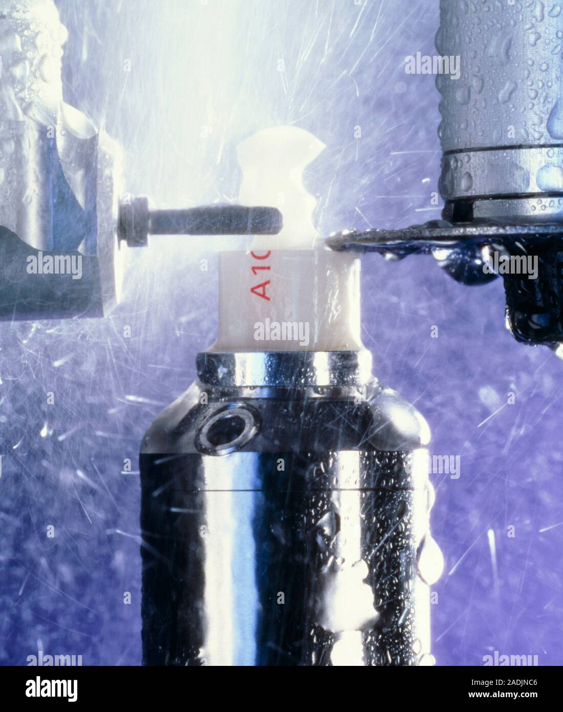 Dental inlay cutting. (Image 2 of 3). Macrophotograph of a dental inlay ...