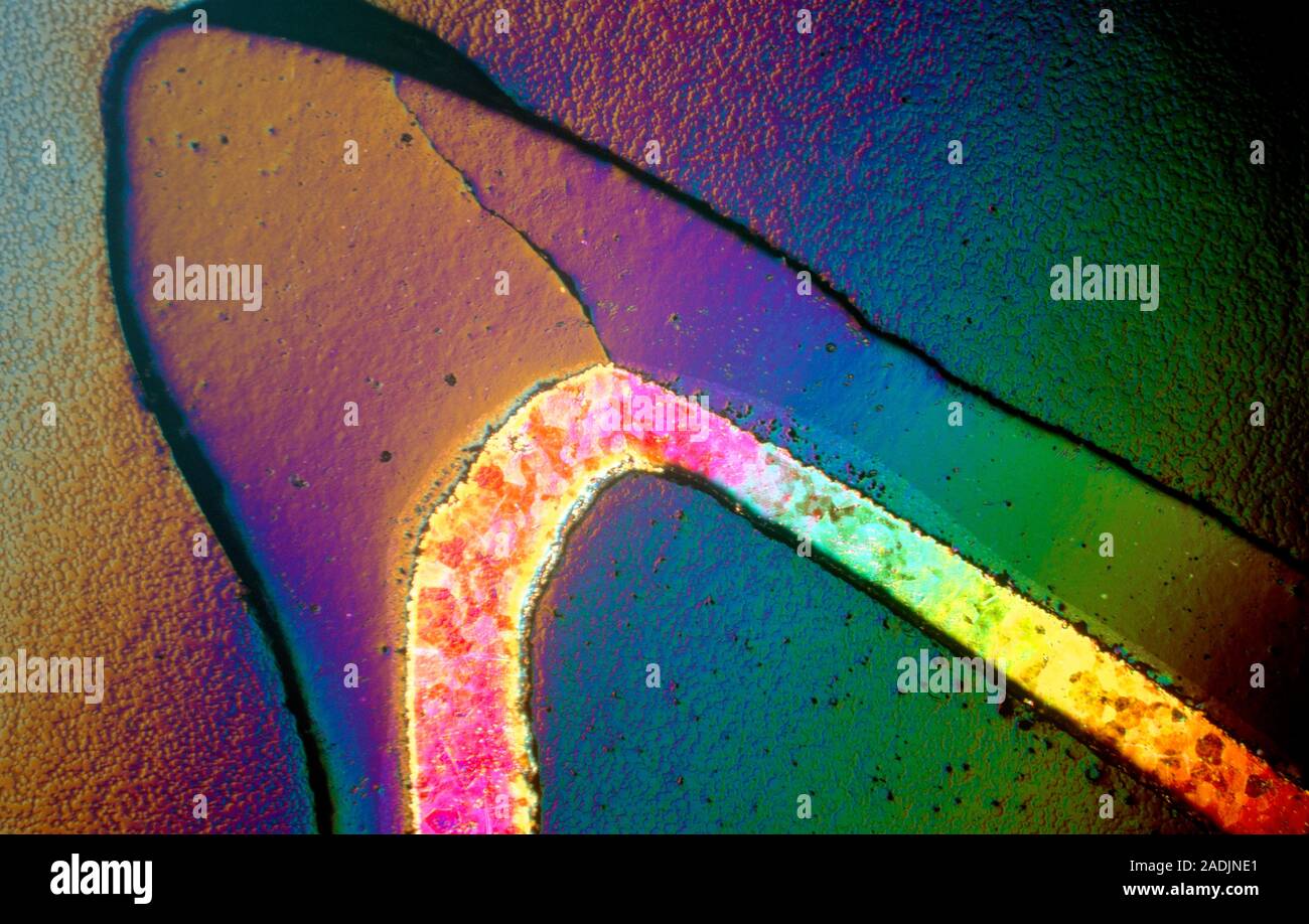 Dental crown. Polarised light micrograph (PLM) of a longitudinal ...