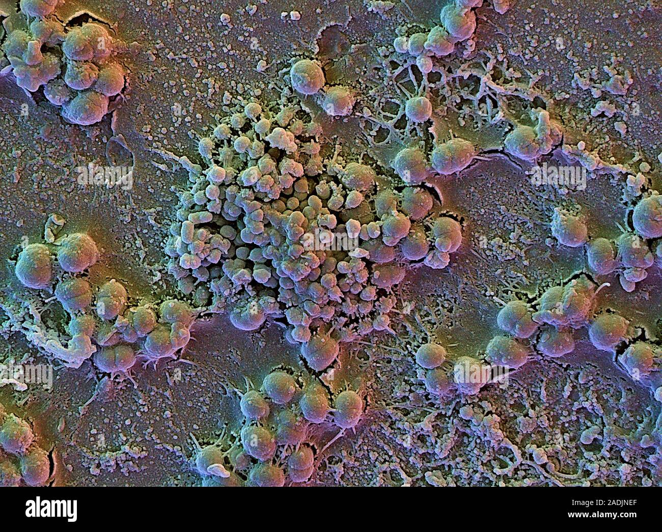 Tooth plaque. Coloured scanning electron micrograph (SEM) of dental ...